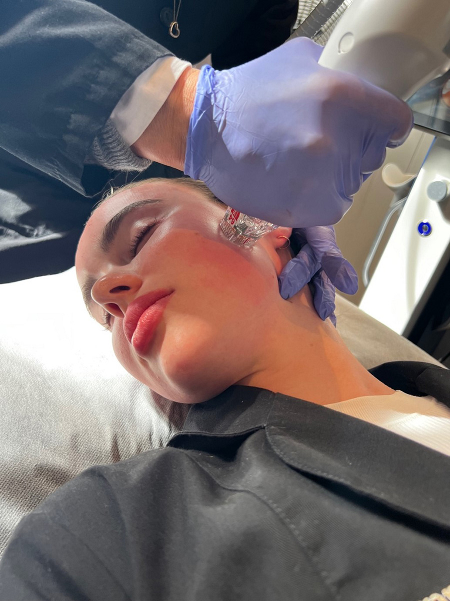 Secret RF | Luxe Appearance | Appearance Medicine Specialists